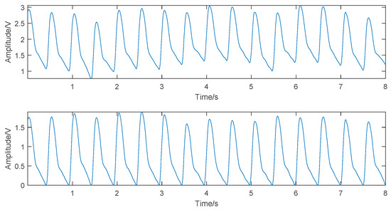 Sensors | Free Full-Text | A Non-Invasive Continuous Blood Pressure ...