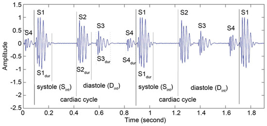 Real-Time Smart-Digital Stethoscope System for Heart Diseases Monitoring