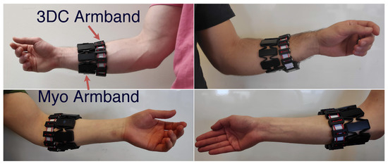 A Low-Cost, Wireless, 3-D-Printed Custom Armband for sEMG Hand Gesture ...