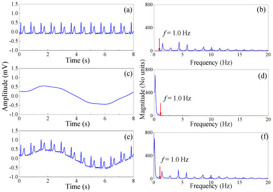 Sensors | Free Full-Text | Adaptive Motion Artifact Reduction Based on ...