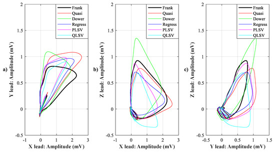 Comparison of Different Electrocardiography with Vectorcardiography ...