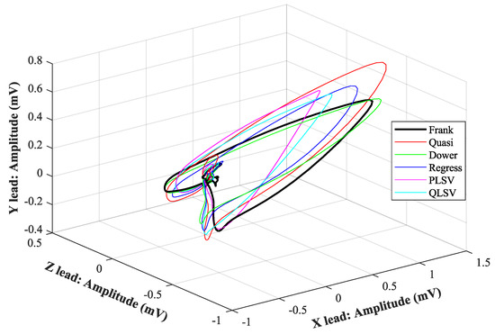 Comparison of Different Electrocardiography with Vectorcardiography ...