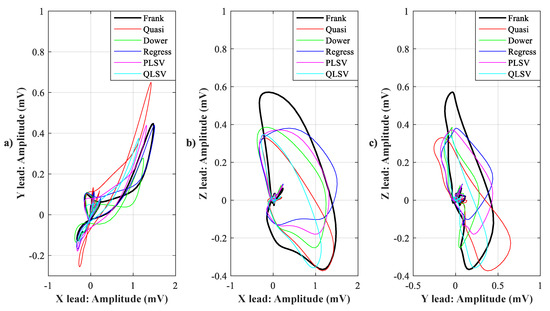 Comparison of Different Electrocardiography with Vectorcardiography ...