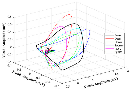 Comparison of Different Electrocardiography with Vectorcardiography ...