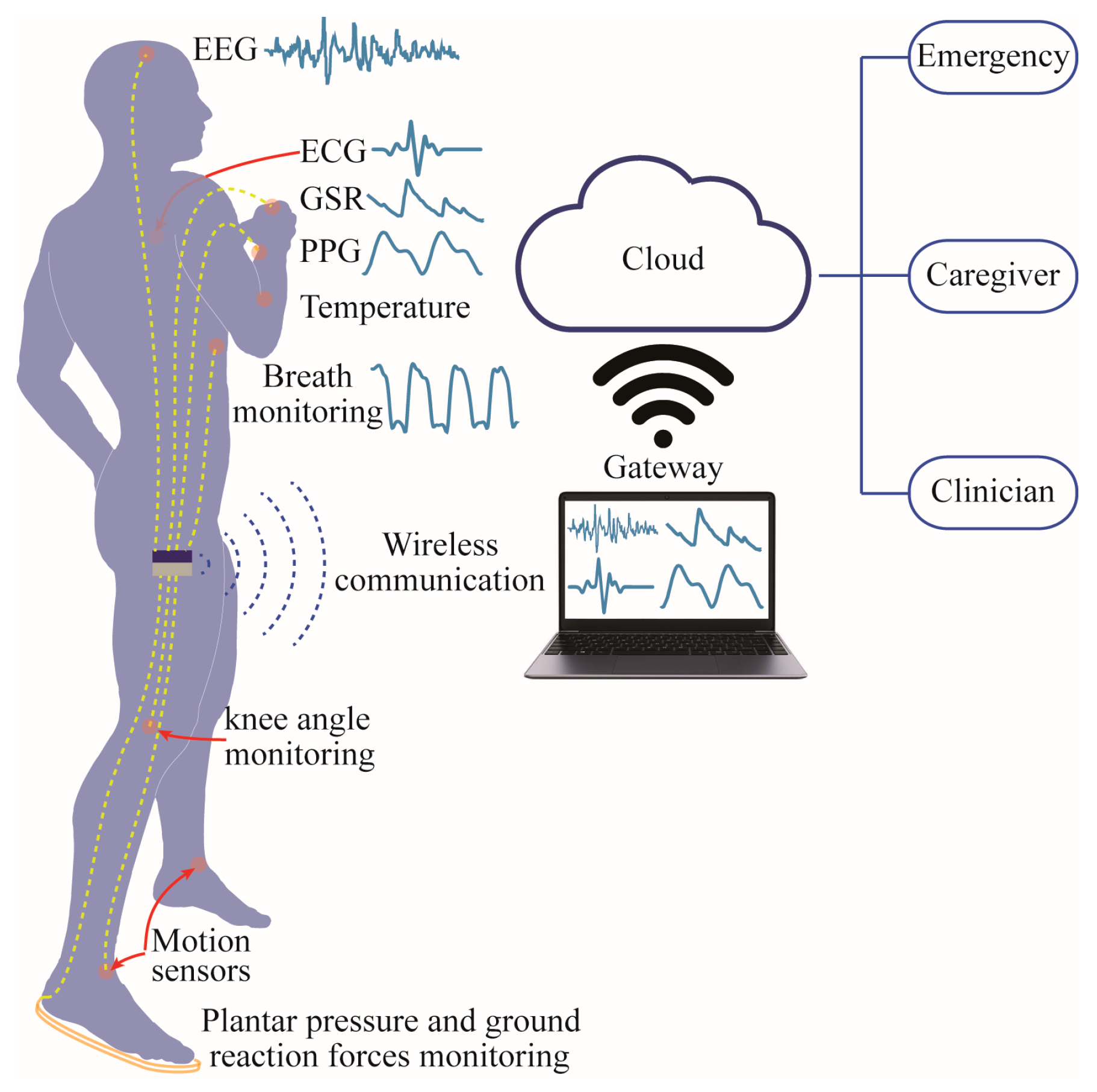 Polymer Optical Fiber Sensors in Healthcare Applications: A ...