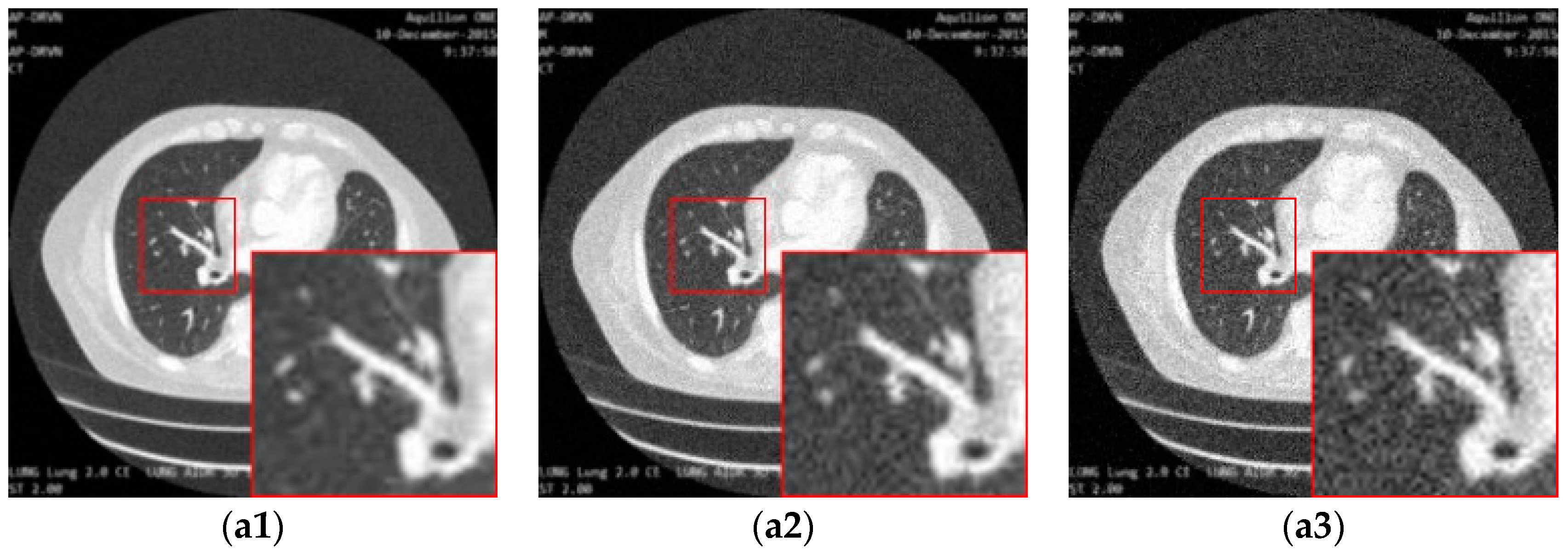 Sensors | Free Full-Text | Computed Tomography (CT) Image Quality ...