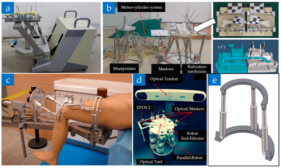 Sensors | Free Full-Text | Medical Robotics in Bone Fracture Reduction ...