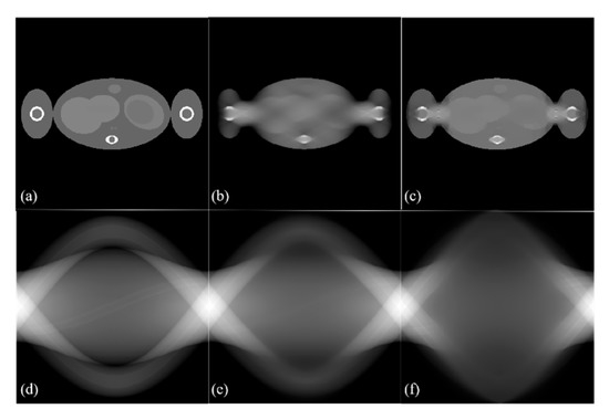 Promising Generative Adversarial Network Based Sinogram Inpainting ...