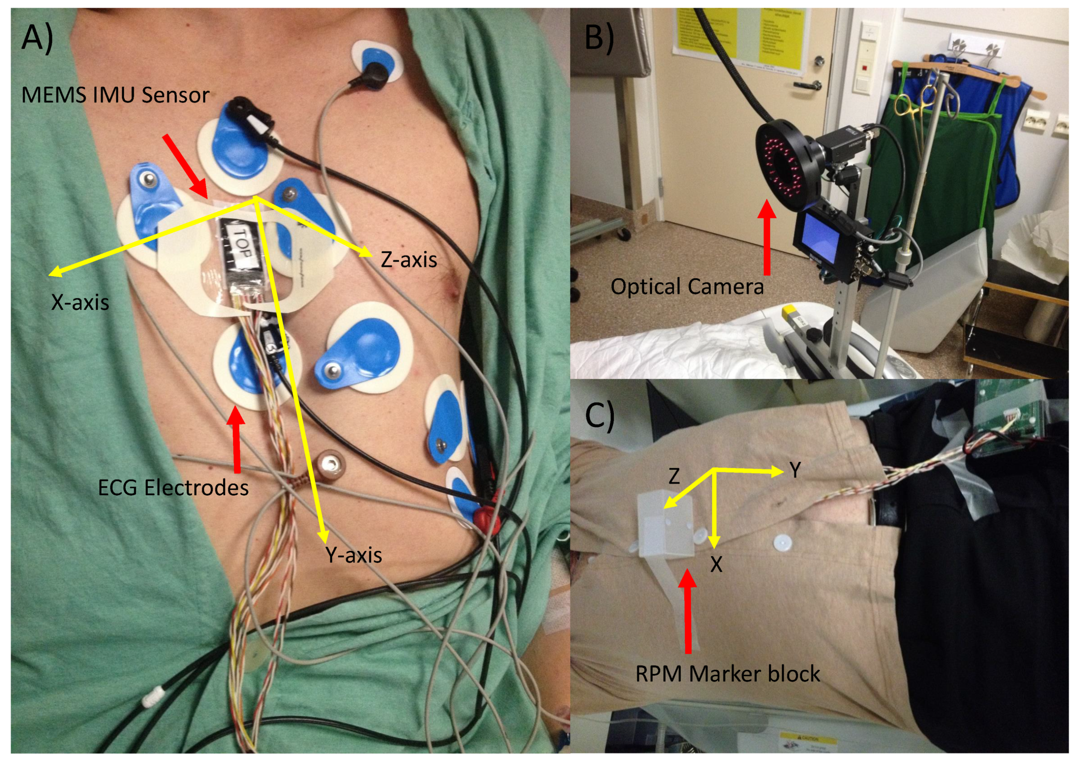 A Computational Framework for Data Fusion in MEMS-Based Cardiac and ...
