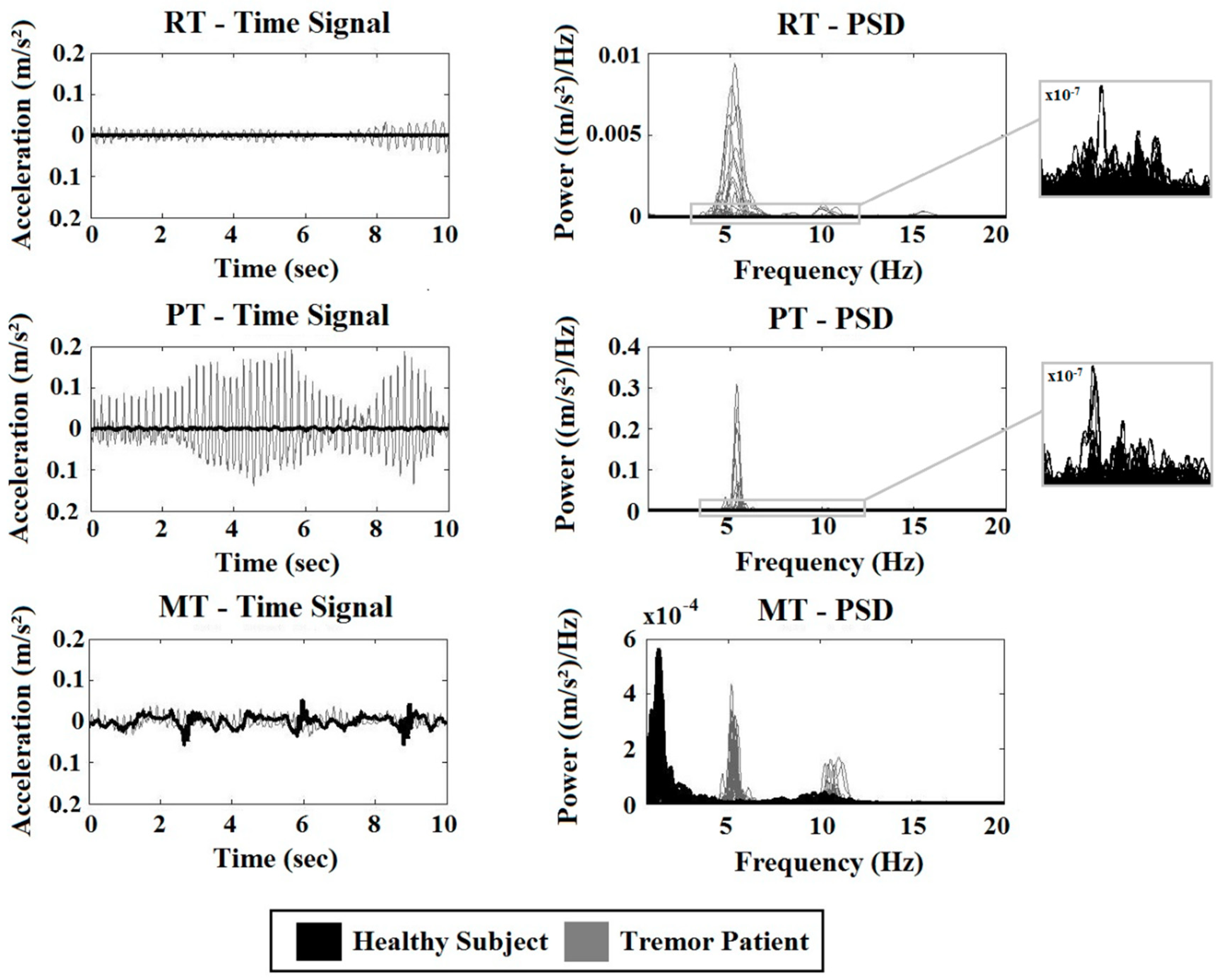 A Power Spectral Density-Based Method to Detect Tremor and Tremor ...