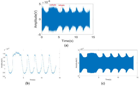 Noncontact Detection of Respiration Rate Based on Forward Scatter Radar