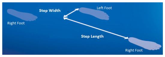 General Mental Health Is Associated with Gait Asymmetry