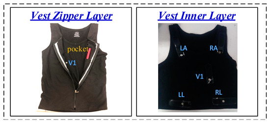 A Low-Power High-Data-Transmission Multi-Lead ECG Acquisition Sensor System