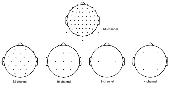 Super-Resolution for Improving EEG Spatial Resolution using Deep Convolutional Neural Network ...