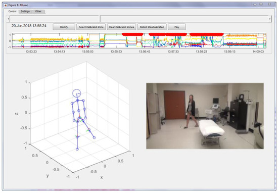 Allumo: Preprocessing and Calibration Software for Wearable ...