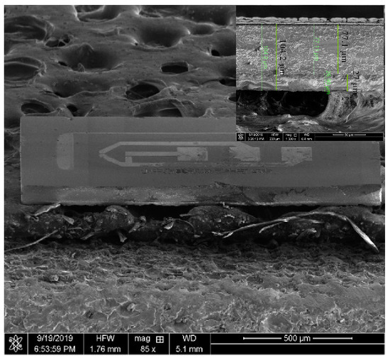 A Novel Piezoresistive MEMS Pressure Sensors Based on Temporary Bonding ...