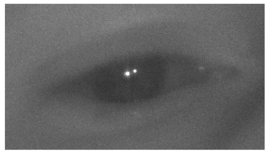 Hybrid Eye-Tracking on a Smartphone with CNN Feature Extraction and an ...