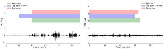 Sensors | Special Issue : Advanced Signal Processing in Wearable ...