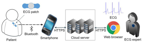 A Wearable Electrocardiogram Telemonitoring System for Atrial ...