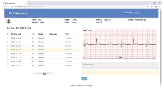 A Wearable Electrocardiogram Telemonitoring System for Atrial ...