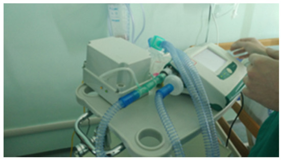 A Low-Cost Breath Analyzer Module in Domiciliary Non-Invasive ...