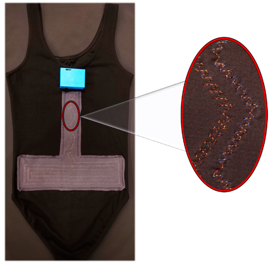 Wearable Device to Monitor Back Movements Using an Inductive Textile Sensor