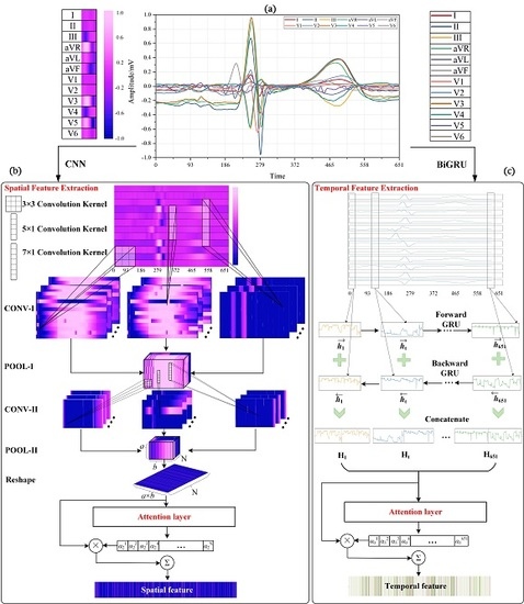 Sensors | Free Full-Text | Hybrid Network with Attention Mechanism for Detection and Location of ...