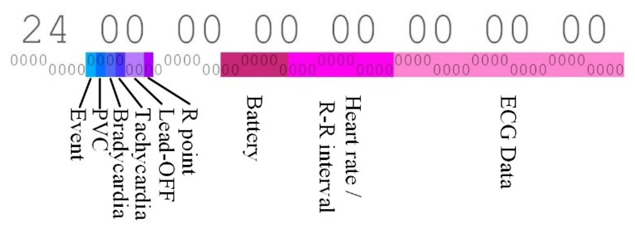 Vital Block and Vital Sign Server for ECG and Vital Sign Monitoring in ...