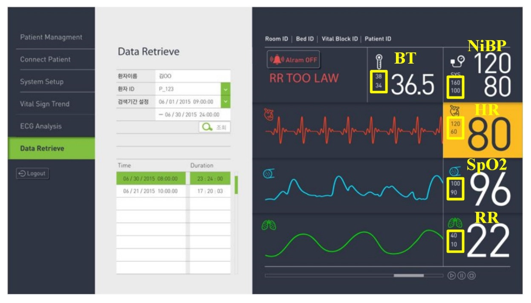 Vital Block and Vital Sign Server for ECG and Vital Sign Monitoring in ...