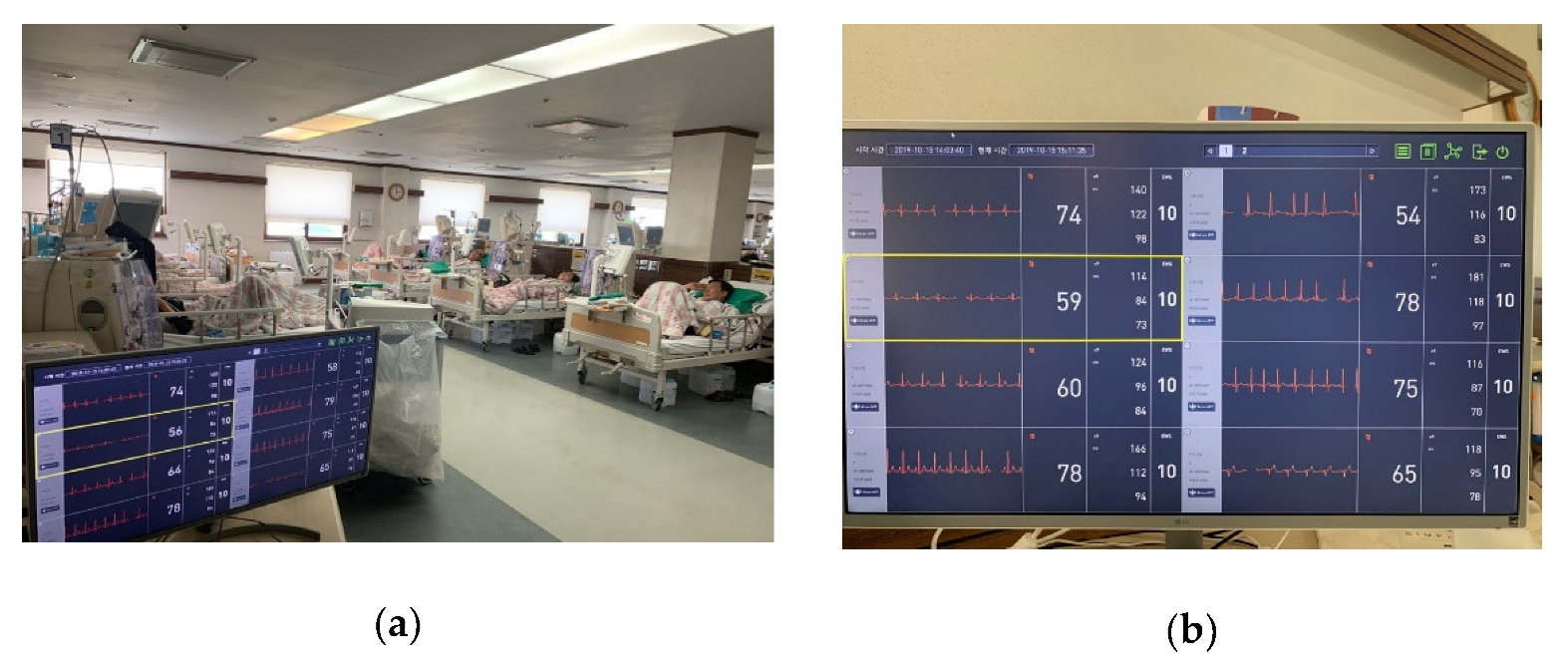 Vital Block and Vital Sign Server for ECG and Vital Sign Monitoring in ...