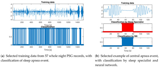 Sleep Apnea Detection with Polysomnography and Depth Sensors