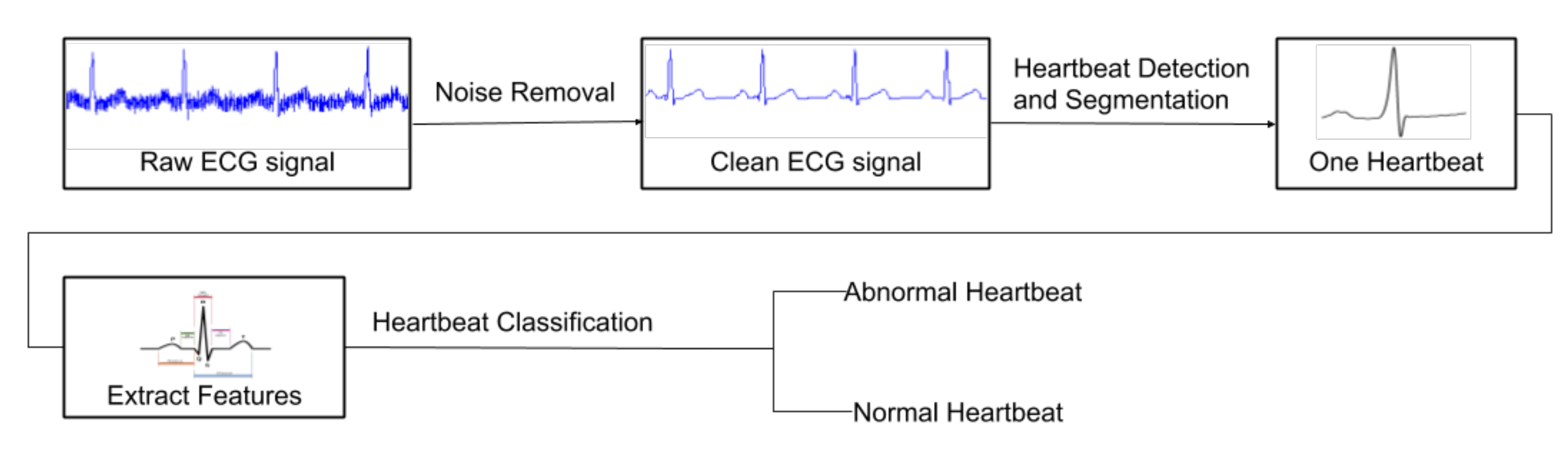 A Survey of Heart Anomaly Detection Using Ambulatory Electrocardiogram (ECG)