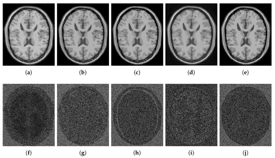Non-Local SVD Denoising of MRI Based on Sparse Representations