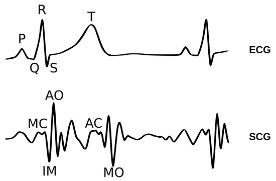 Detection and Analysis of Heartbeats in Seismocardiogram Signals
