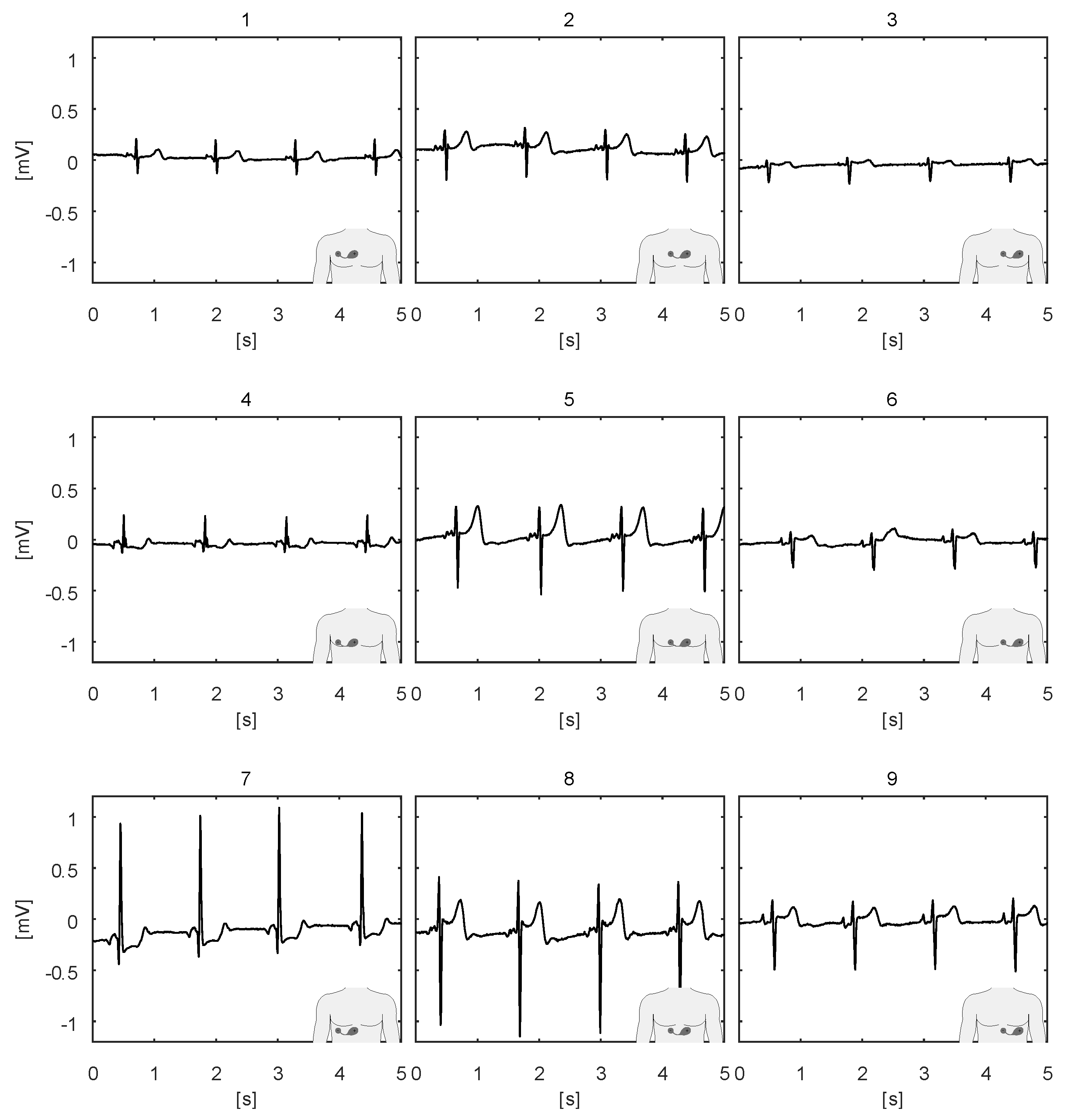 Sensors | Free Full-Text | Medical-Grade ECG Sensor for Long-Term ...