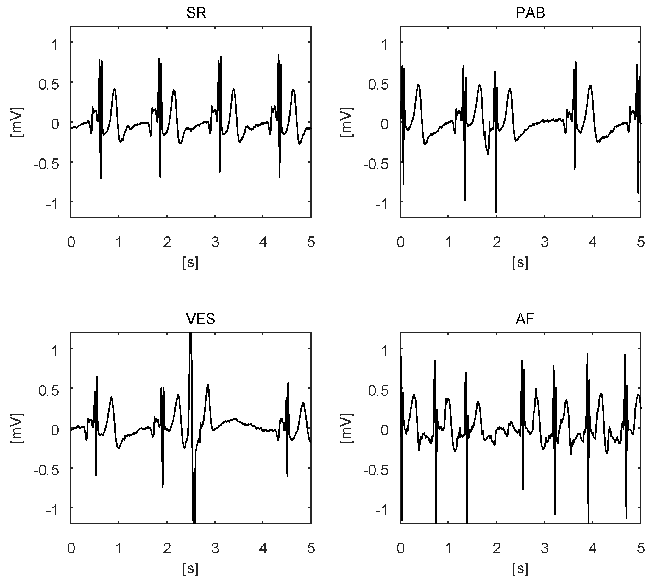 Sensors | Free Full-Text | Medical-Grade ECG Sensor for Long-Term ...