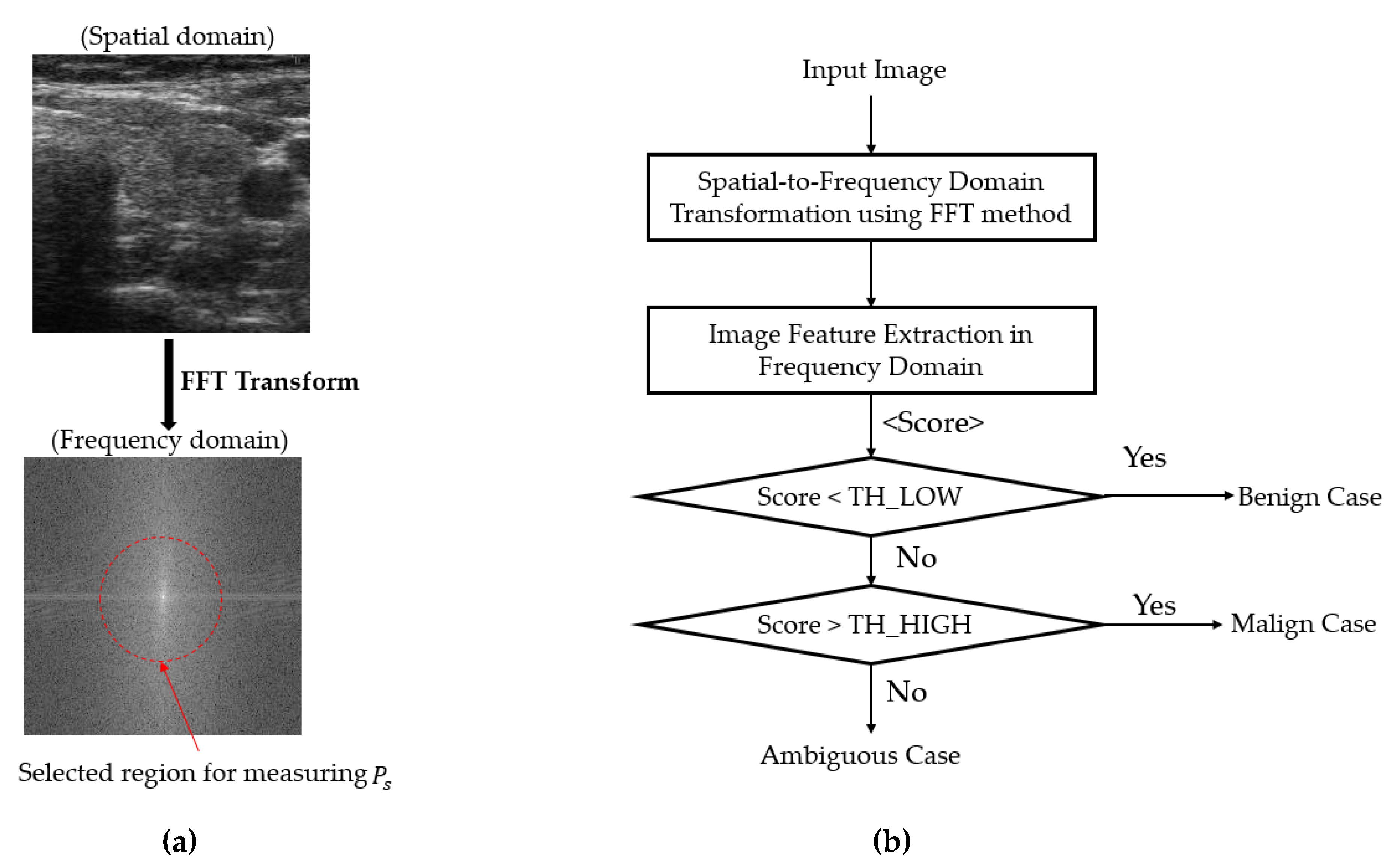 Sensors | Free Full-Text | Ultrasound Image-Based Diagnosis of ...