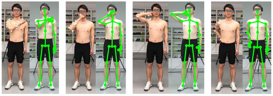 Deep Learning-Based Upper Limb Functional Assessment Using a Single Kinect v2 Sensor