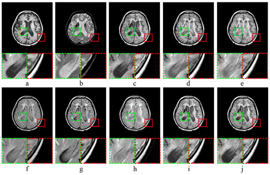Multi-Modality Medical Image Fusion Using Convolutional Neural Network ...