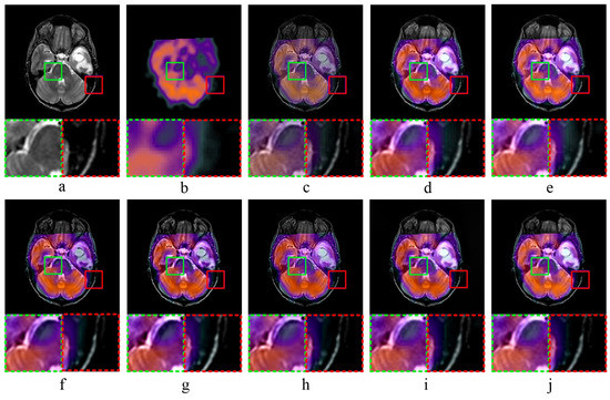 Multi-Modality Medical Image Fusion Using Convolutional Neural Network ...