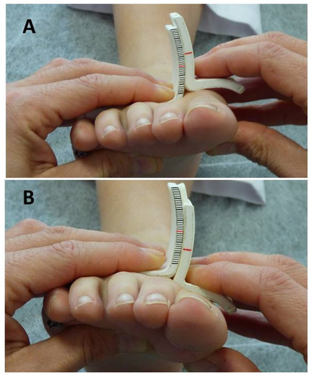 The Validity and Reliability of a New Simple Instrument for the ...
