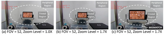 Foveation Pipeline for 360° Video-Based Telemedicine