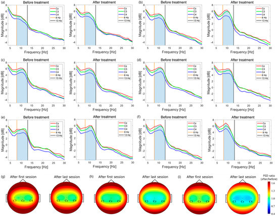 Quantitative Analysis of EEG Power Spectrum and EMG Median Power ...