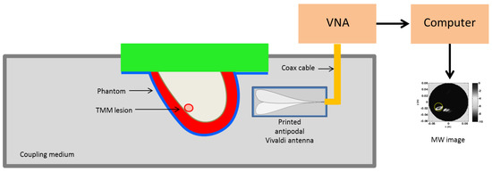 Multimodal Breast Phantoms for Microwave, Ultrasound, Mammography ...