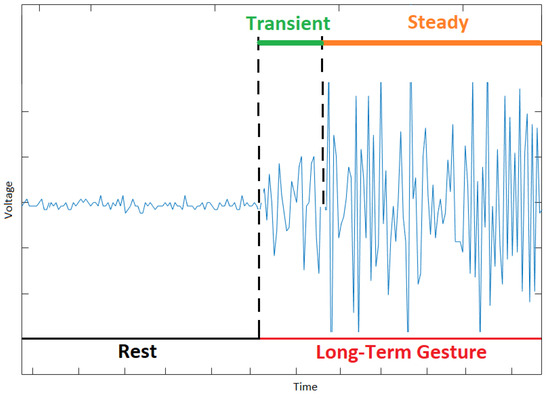 Sensors | Special Issue : EMG Sensors and Applications