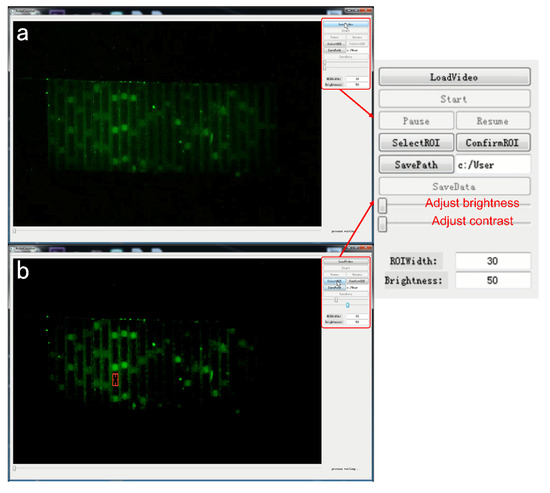 Miniaturized Continuous-Flow Digital PCR for Clinical-Level Serum ...