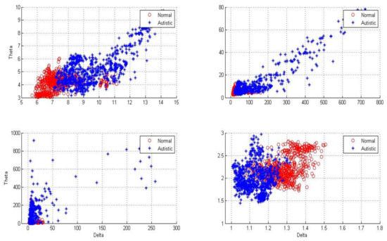 Sensors | Free Full-Text | EEG Signal Analysis for Diagnosing Neurological Disorders Using ...
