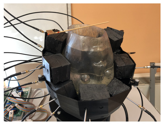 A Prototype Microwave System for 3D Brain Stroke Imaging