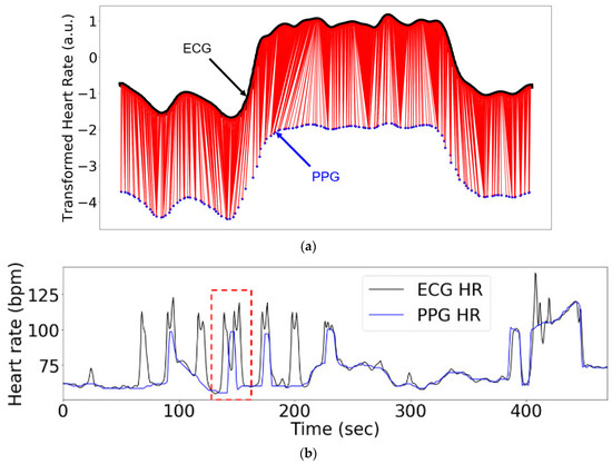 EventDTW: An Improved Dynamic Time Warping Algorithm for Aligning Biomedical Signals of ...