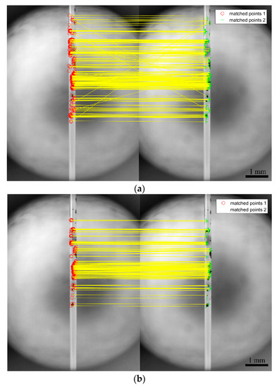 Strain Measurement Based on Speeded-up Robust Feature Algorithm Applied to Microimages from a ...